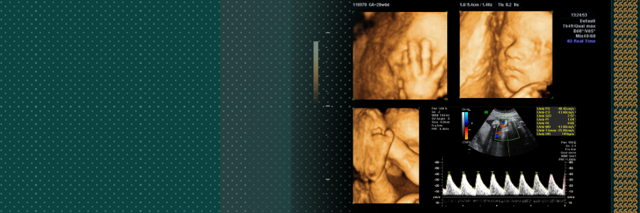 Fetal Well-being Scan in kolkata (28 – 40 weeks GA) - NESA Institute of ...